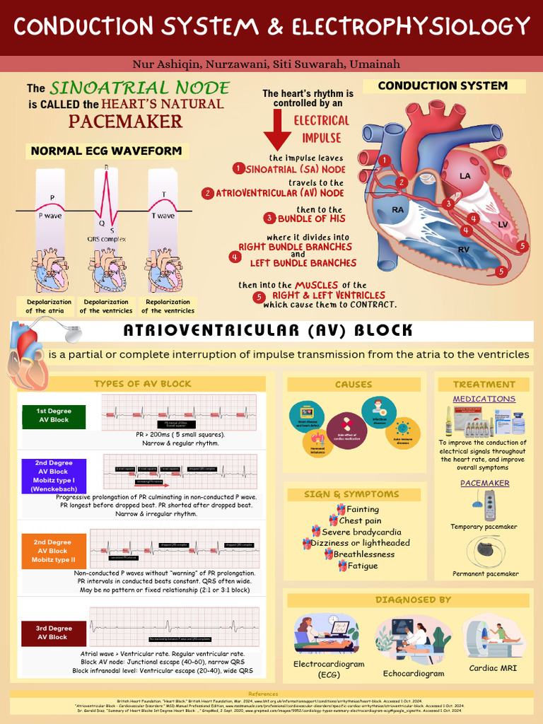 POSTER Conduction system group 3 | PDF
