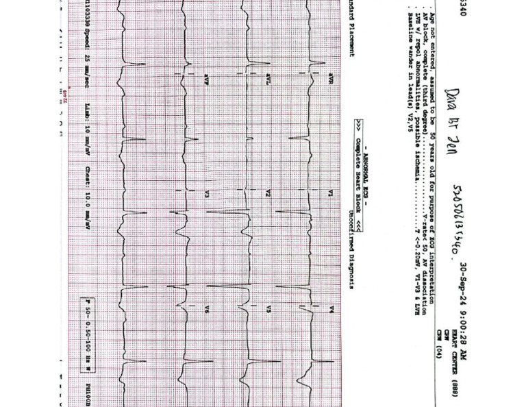 Ecg 1 | PDF