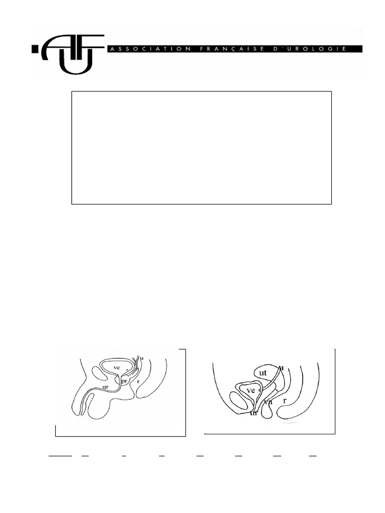 Instillations Endo-Vesicales de BCG: La Vessie | PDF