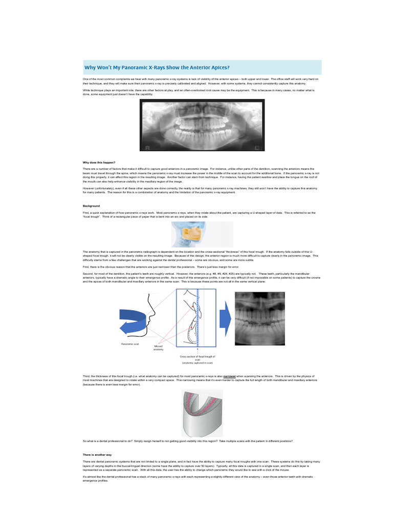 Anterior Apices Opg Error | PDF