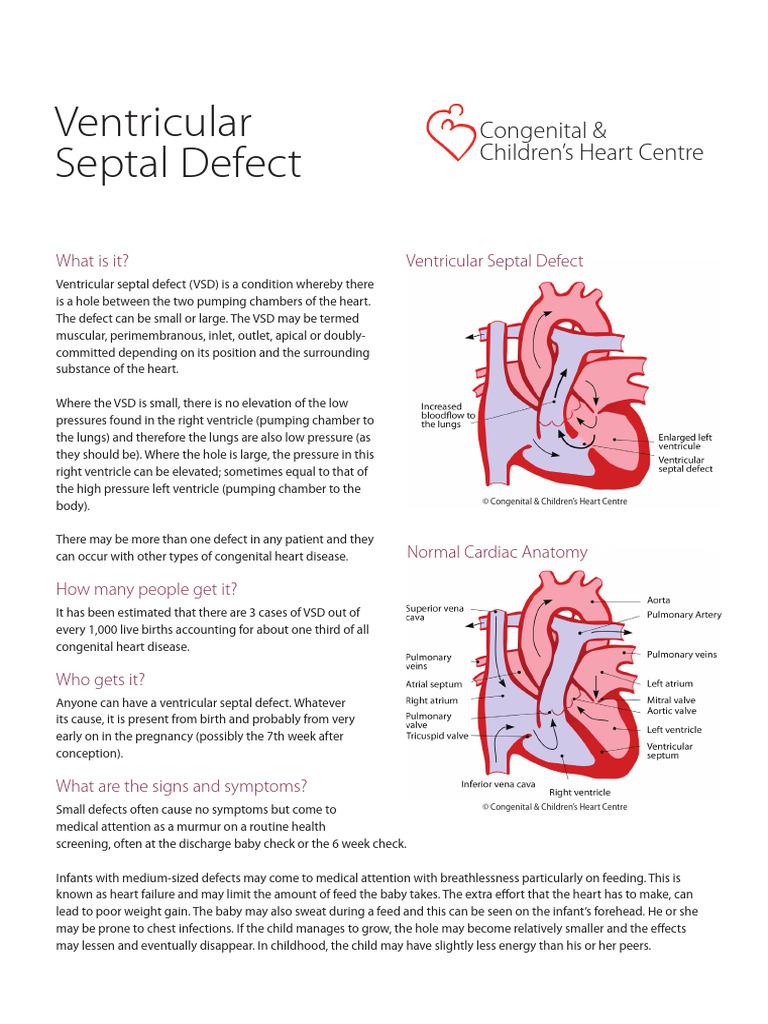 Ventricular Septal Defect | PDF