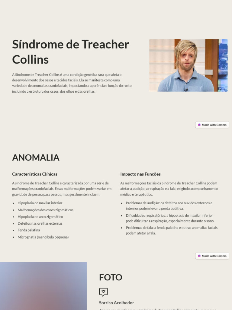 Sindrome de Treacher Collins | PDF