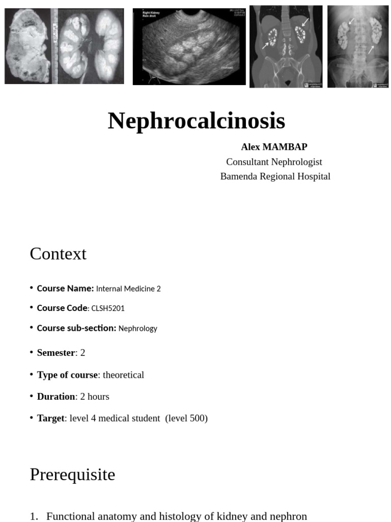 Nephrocalcinosis UBa 2024 | PDF