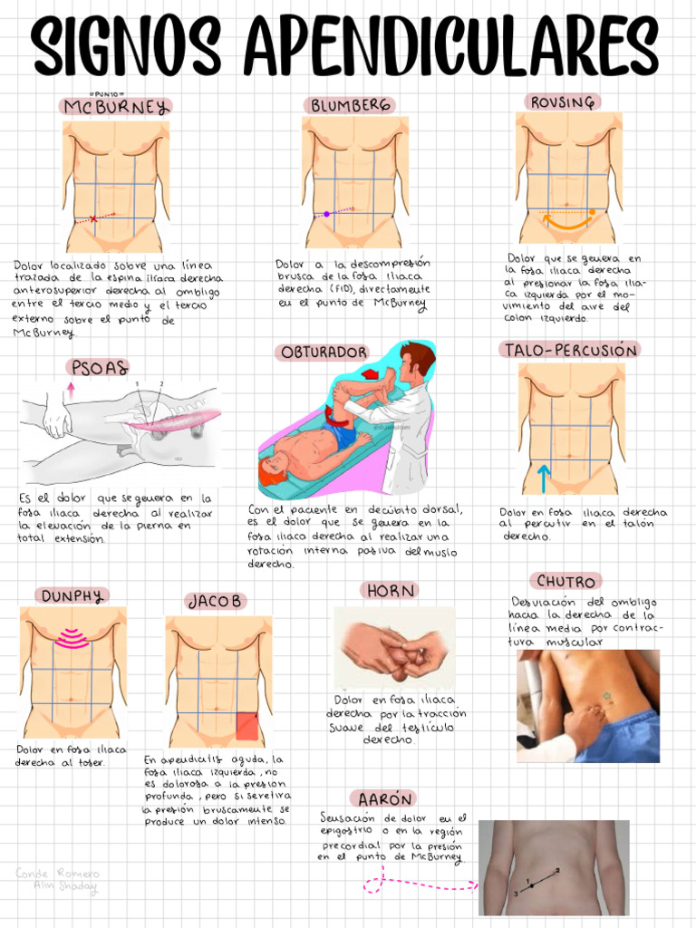 Signos Clínicos de Apendicitis | PDF | Gastroenterología | Enfermedades ...