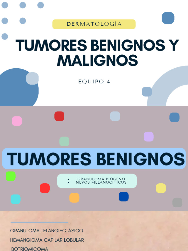 Tumor Es | PDF