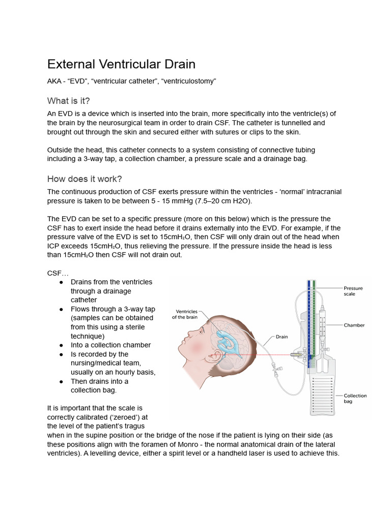 External Ventricular Drain: What Is It? | PDF