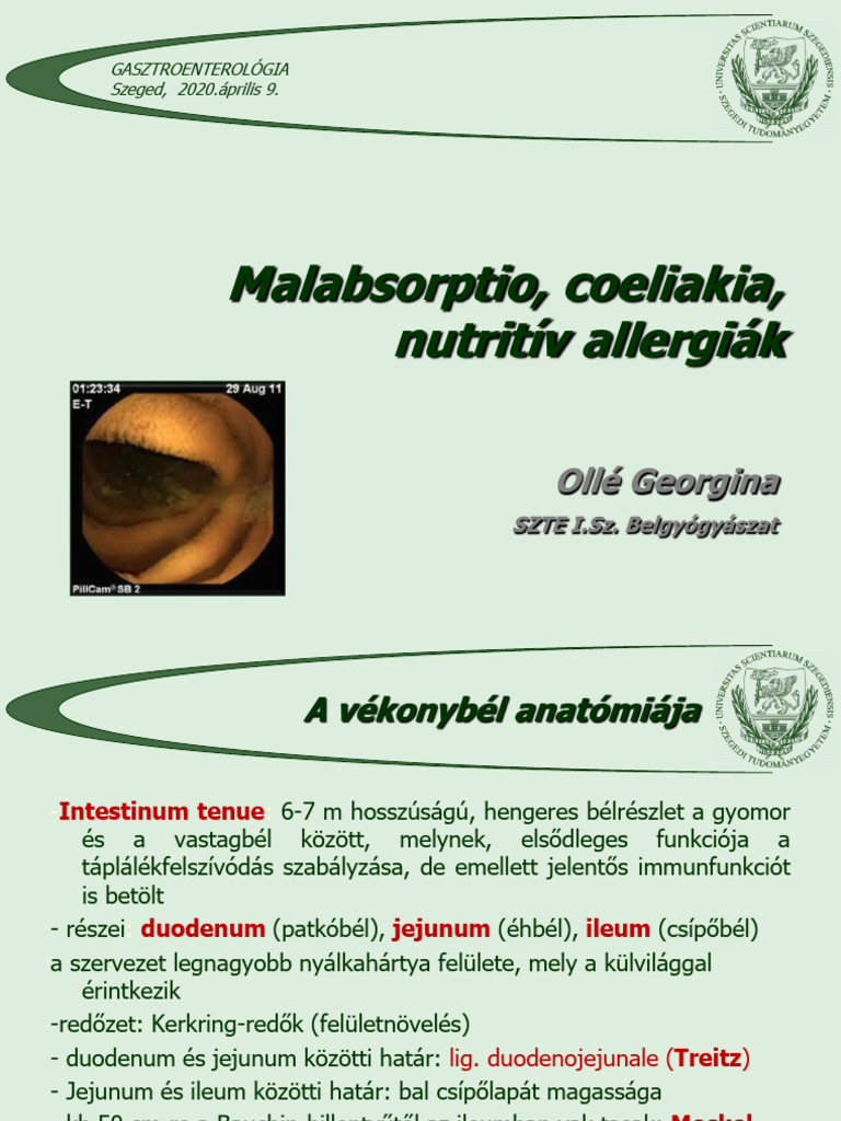 Malabsorptio, Coeliakia, Nutritiv Allergiák-Dr. Ollé G | PDF