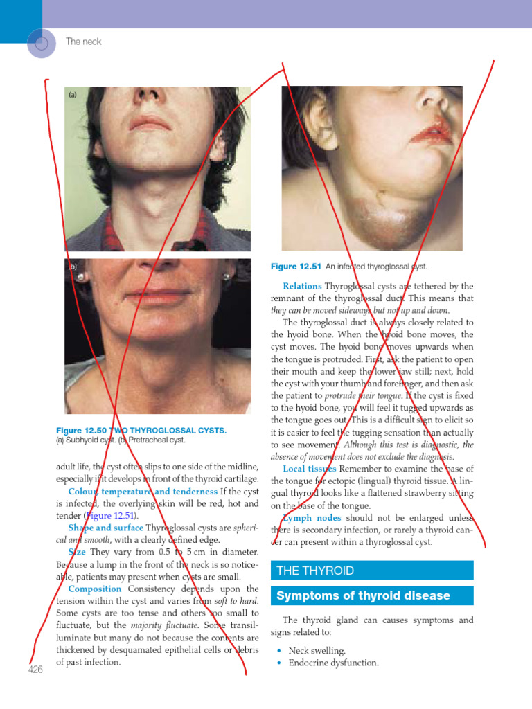 CH.12 Examination of The Thyroid | PDF