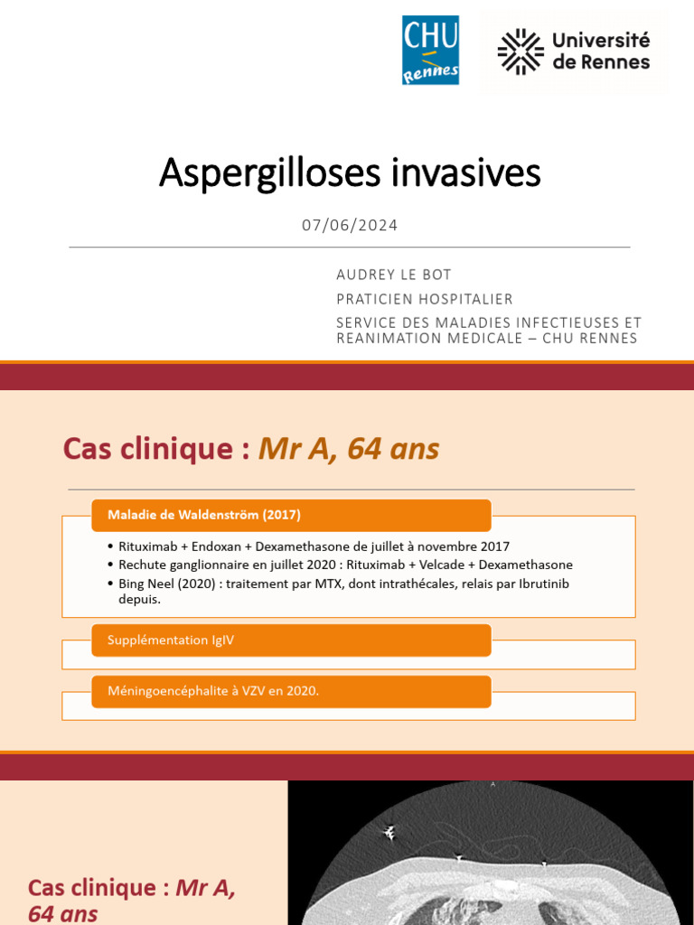 Aspe Invasive DES Pneumo Aspergillose 0706 | PDF