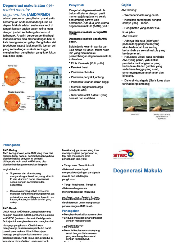 Degenerasi Makula: Gejala dan Penanganan | PDF | Human Eye | Biological ...