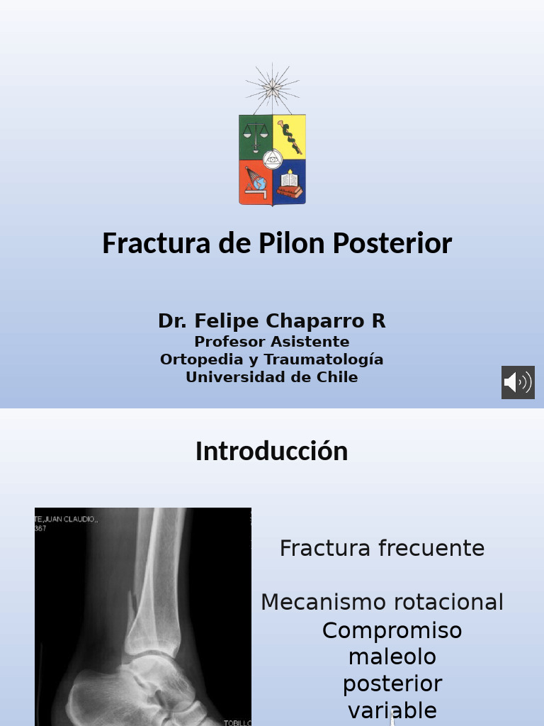 5 - Pilón Posterior Dr. Chaparro | PDF