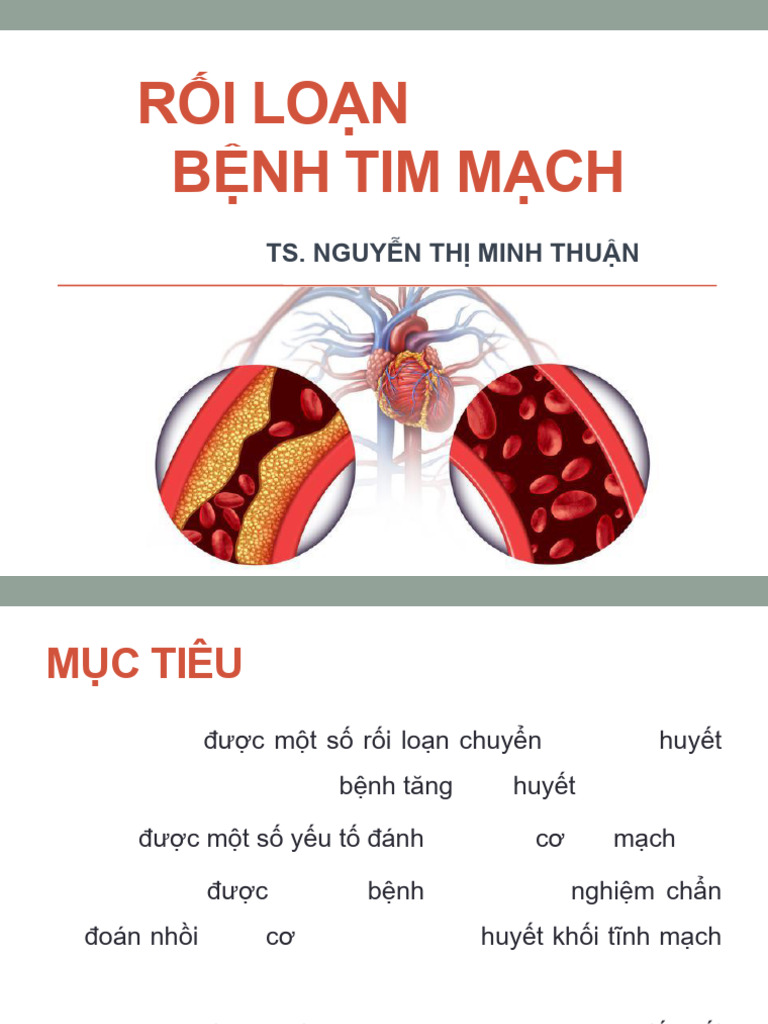Roi Loan Lipid Vã Tim Mach 2023 | PDF