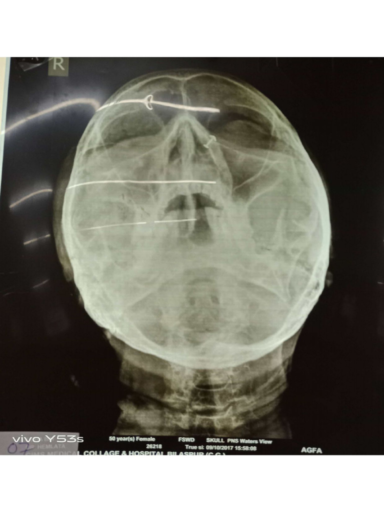 Head and Neck X-Ray | PDF