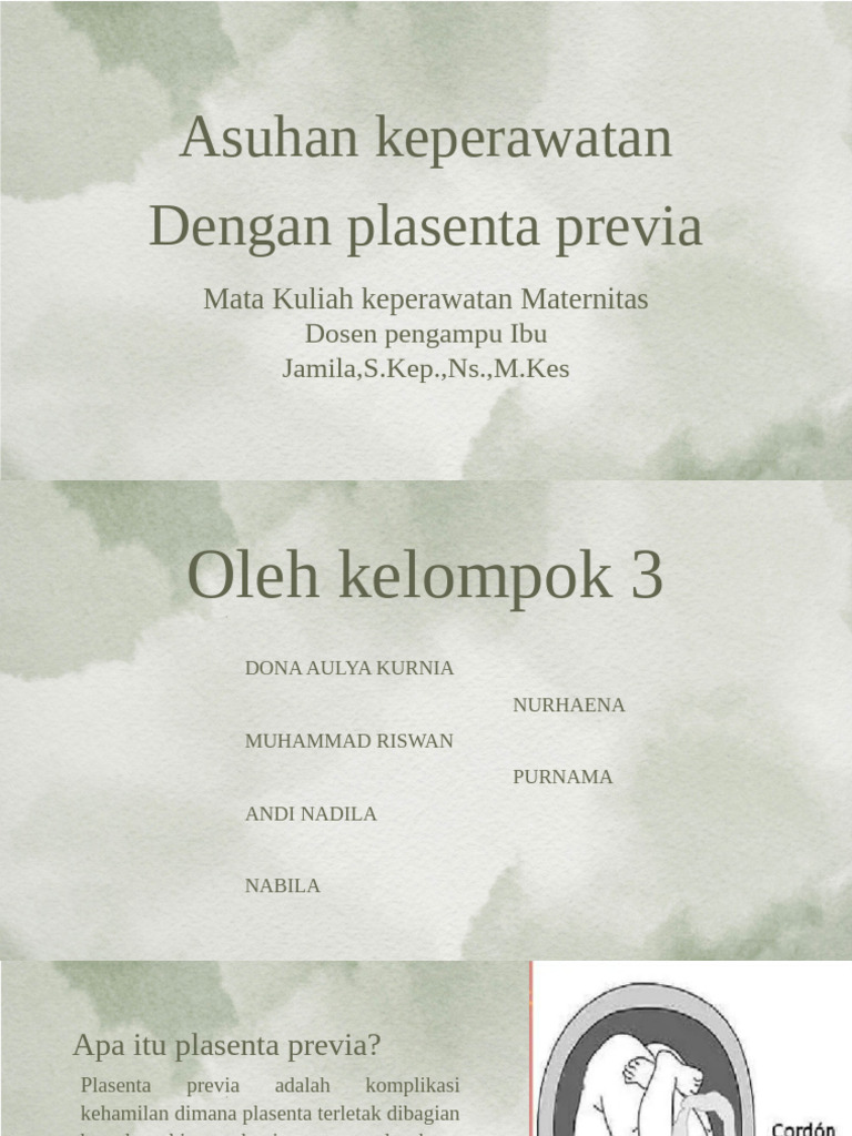 Plasenta Previa | PDF