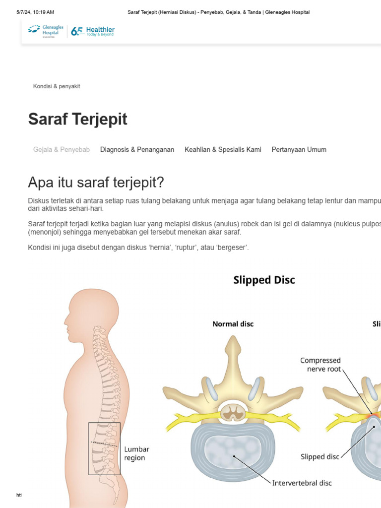 Slip Disc 8 | PDF
