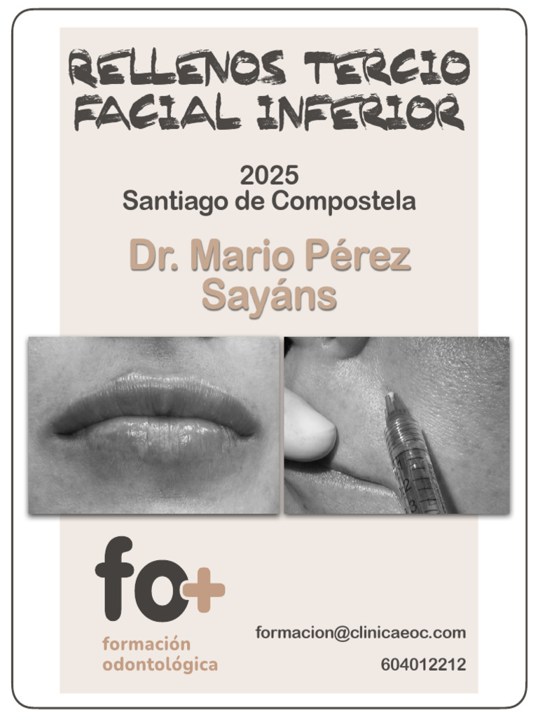 Rellenos Tercio Facial Inferior 2025 | PDF