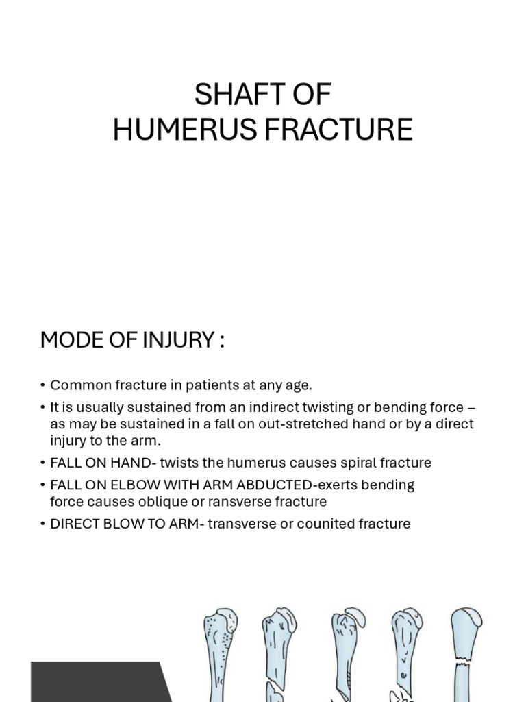 Shaft of Humerus Fracture | PDF | Arm | Anatomical Terms Of Motion