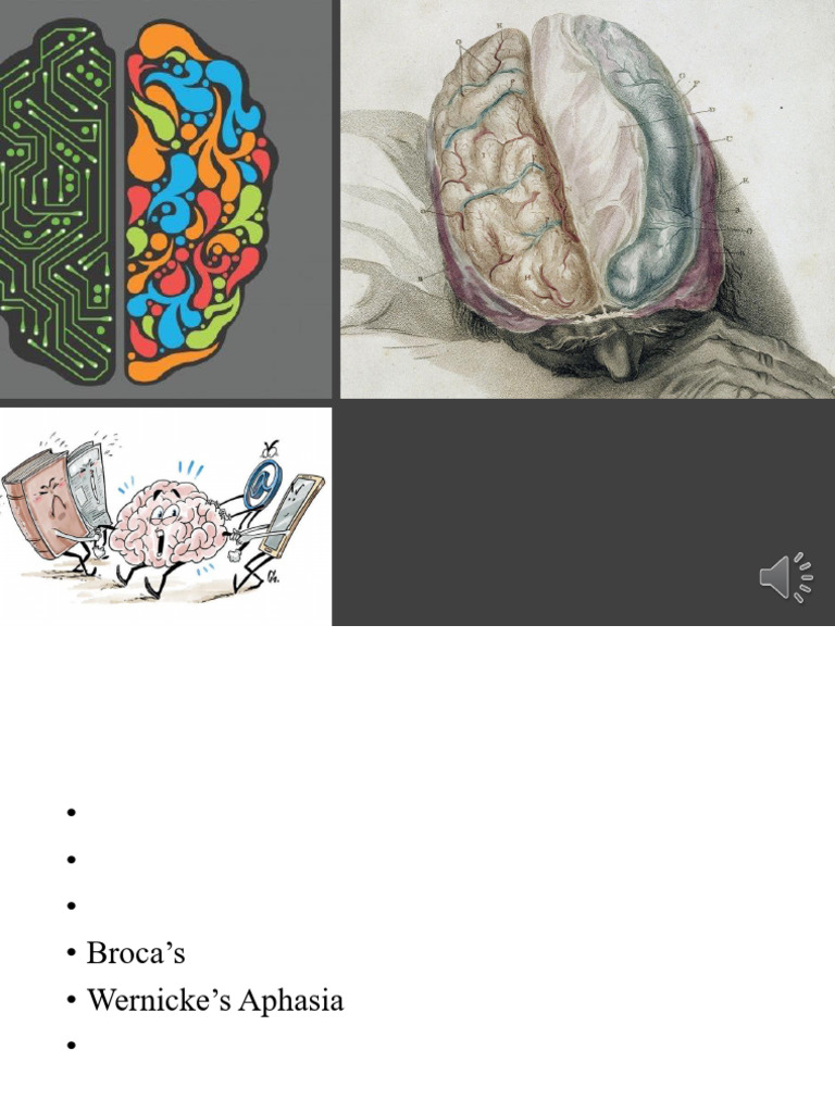 brain-lateralisation-and-language-pdf