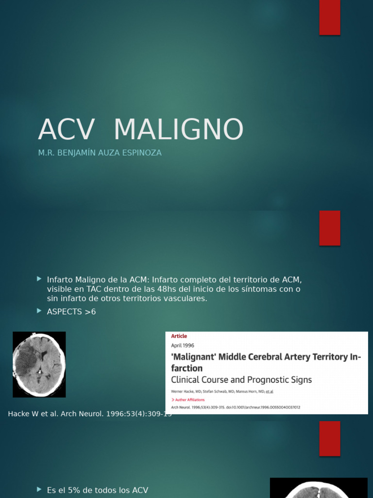 Acv Maligno | PDF