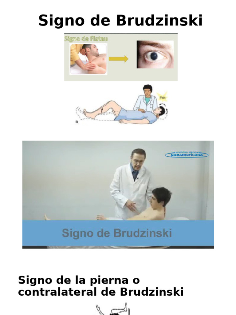 Signo de Brudzinski - Clinica | PDF