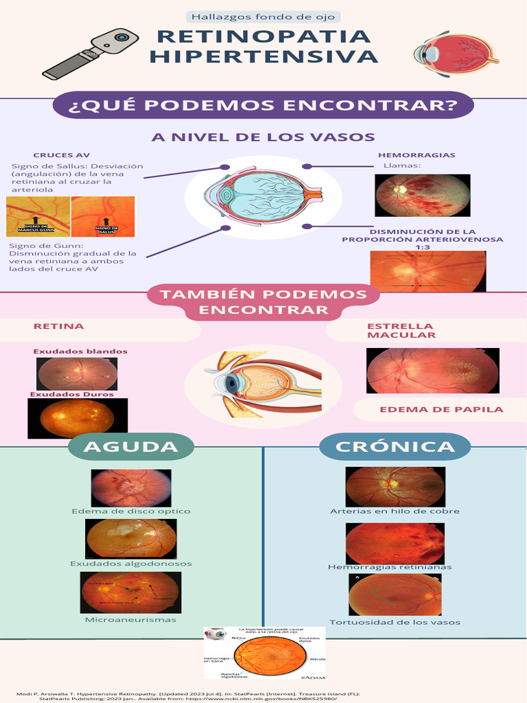 RETINOPATÍA HIPERTENSIVA | PDF