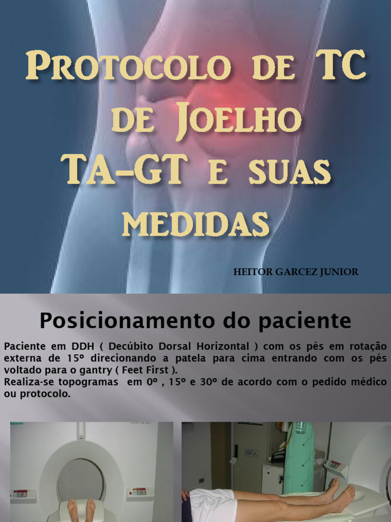 TA-GT | PDF