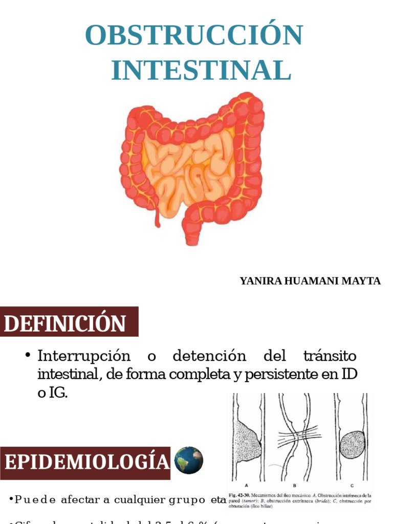 Obstruccion Intestinal | PDF | Abdomen | Ciencia y matemáticas
