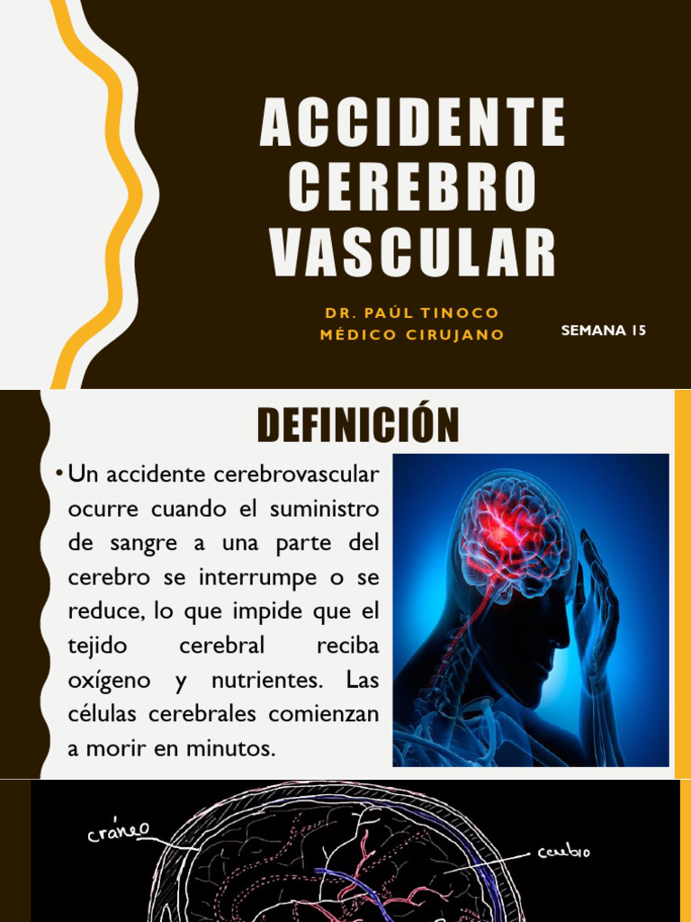 Accidente Cerebro Vascular | PDF