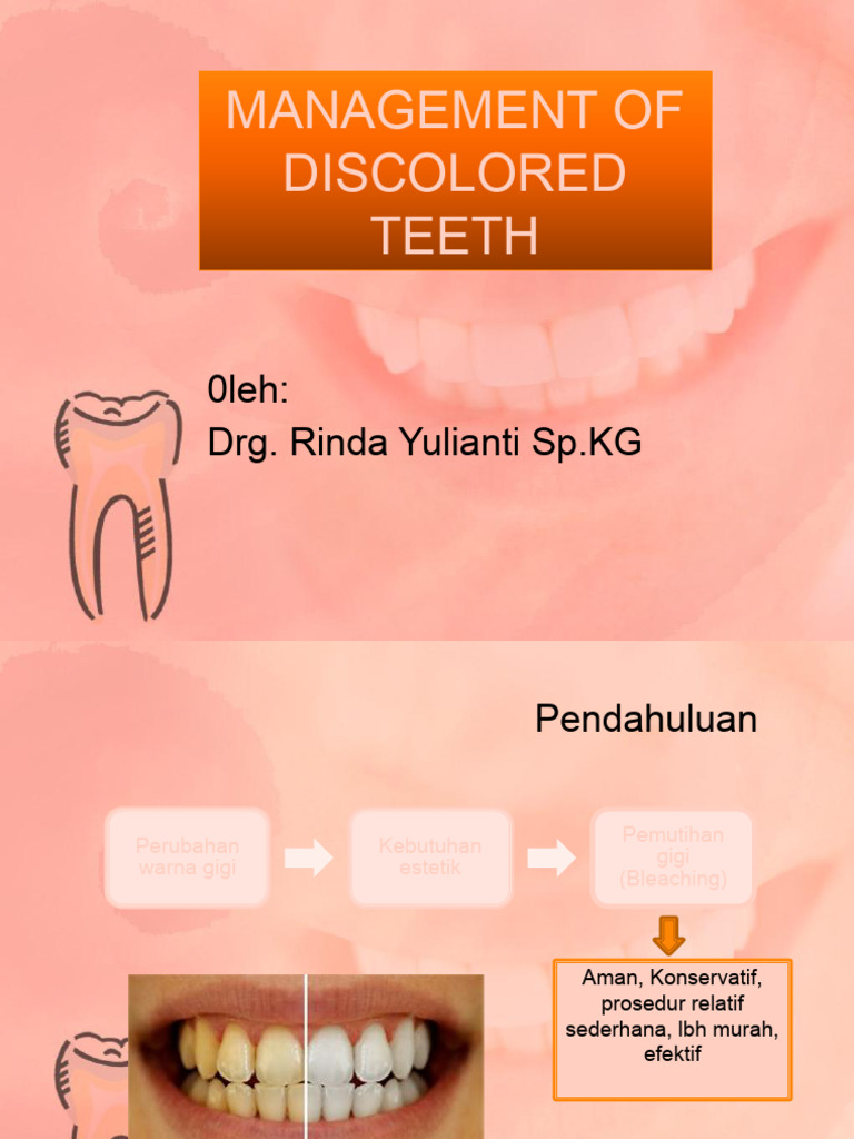 Diskolorasi Bleaching | PDF
