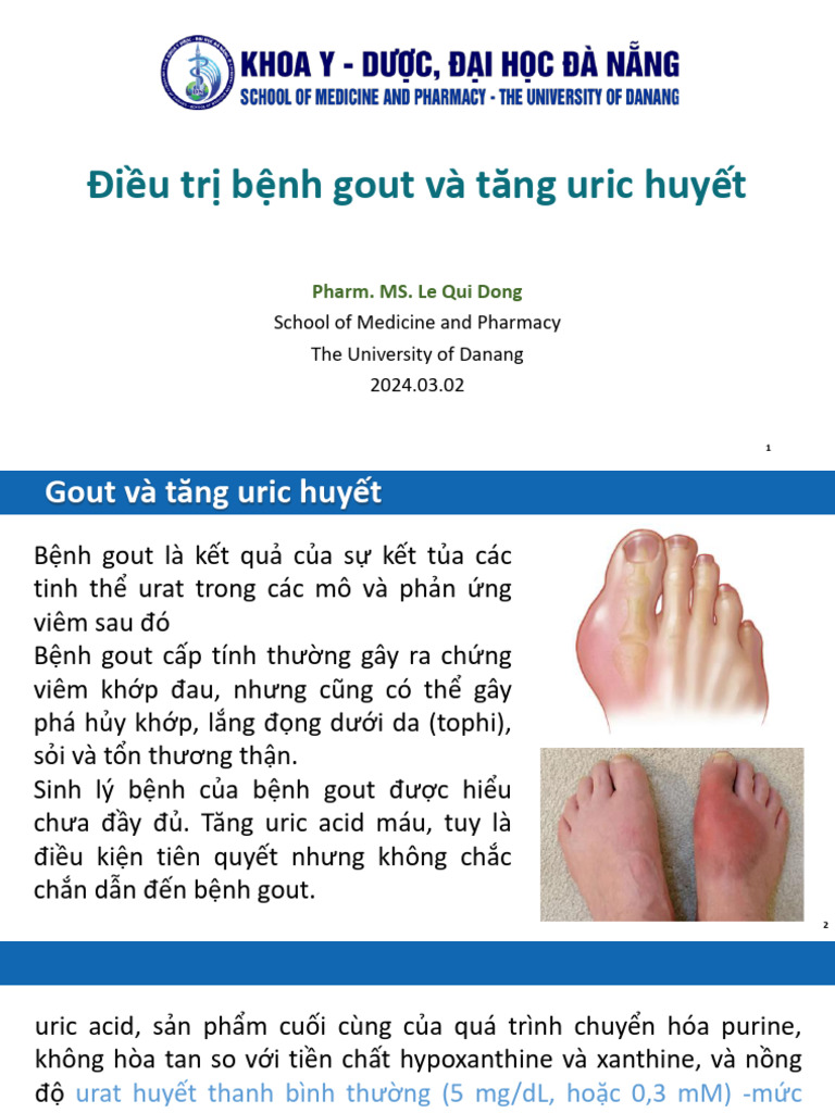3.gout and Hyperuricemia | PDF