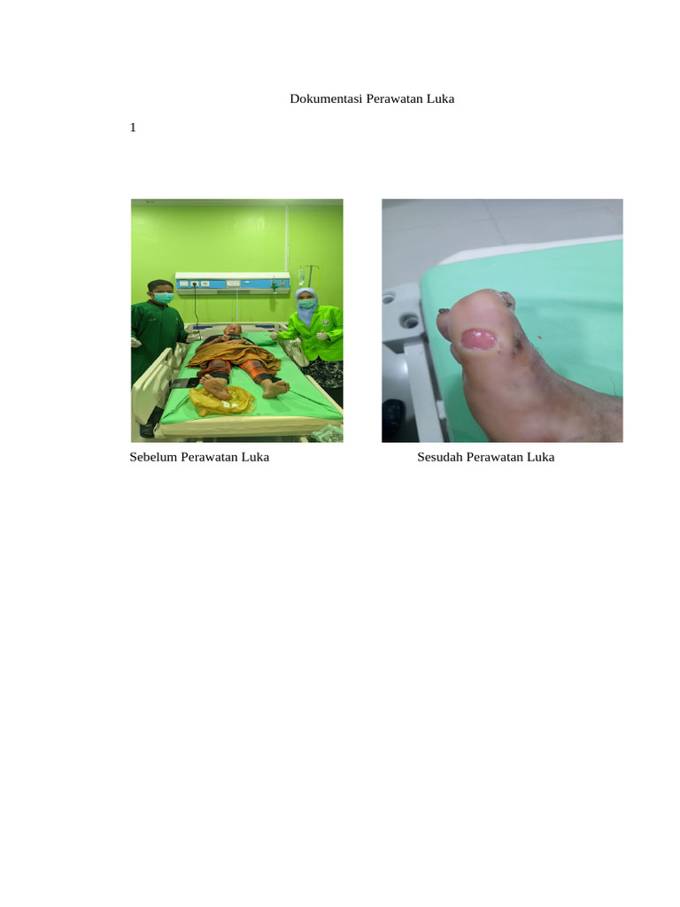 Dokumentasi Perawatan Luka Foto | PDF