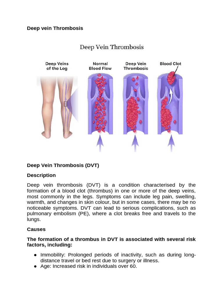 Deep Vein Thrombosis | PDF