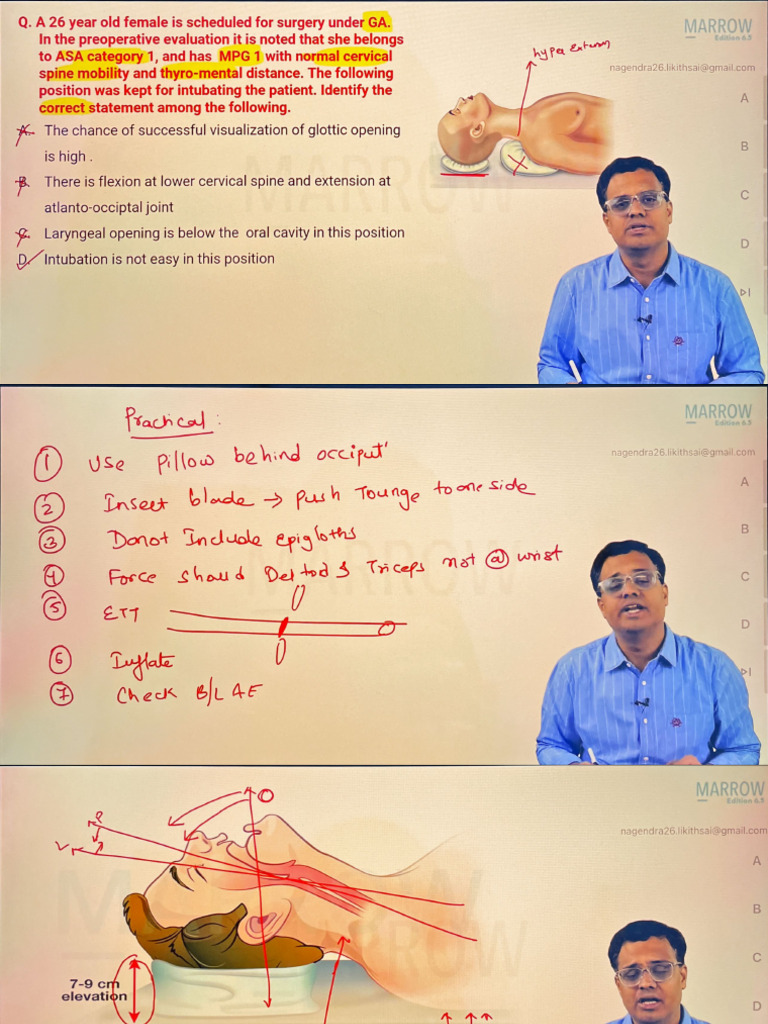 Anes 1 | PDF
