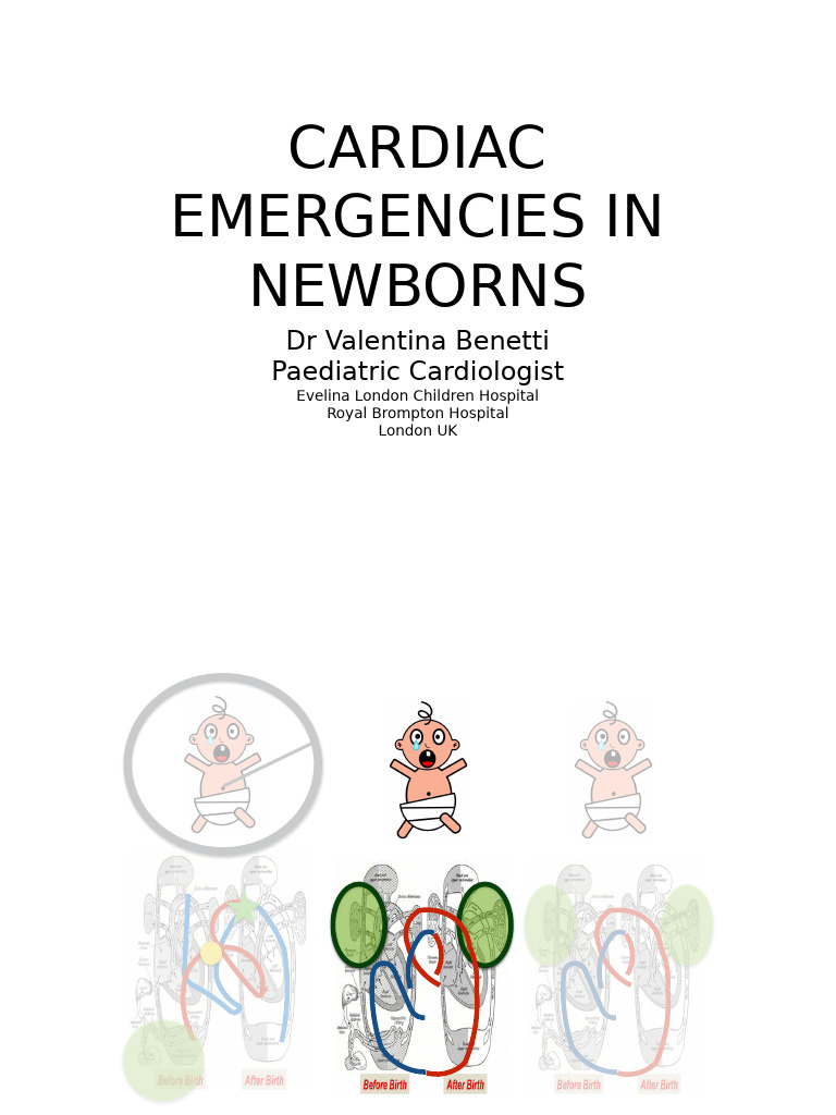 Cardiac Newborn Emergencies | PDF