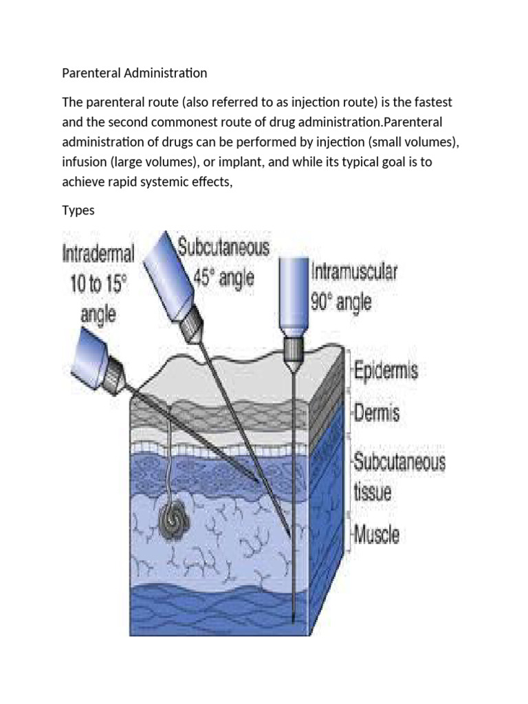 Parenteral Administration | PDF | Injection (Medicine) | Wellness