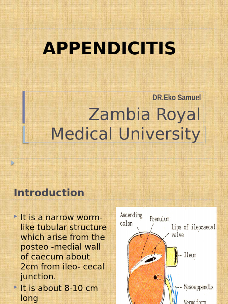 Appendicitis | PDF