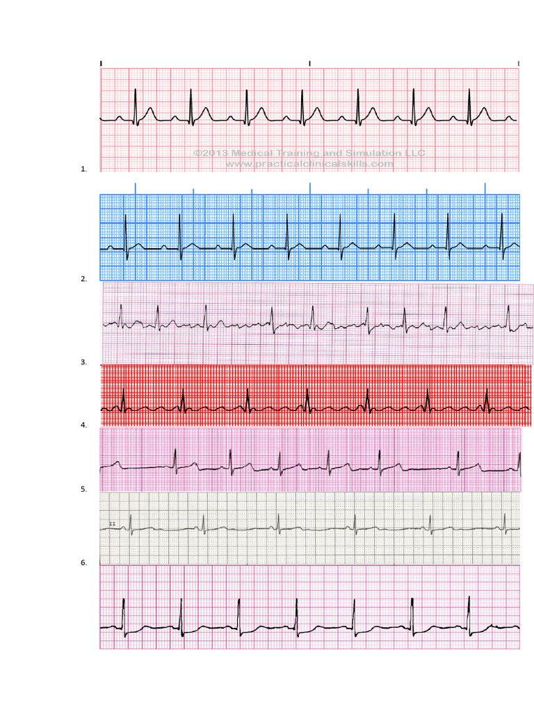 Heart Rate Calculation | PDF | Travel | Science & Mathematics