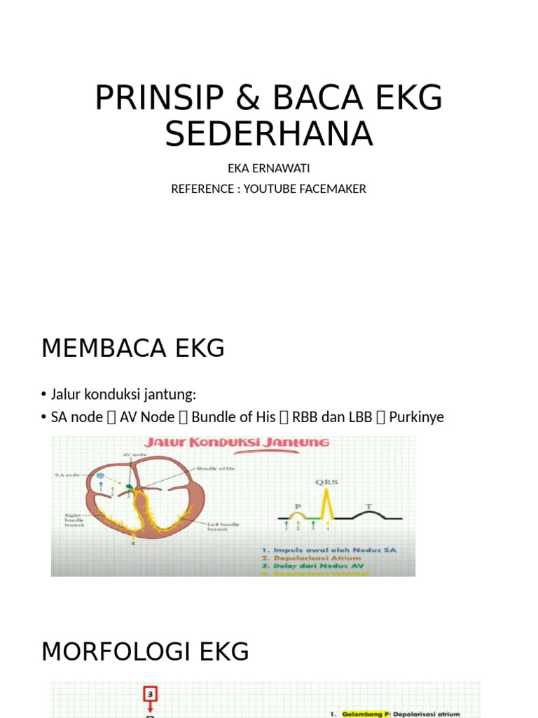 Resume - Eka - Prinsip & Baca Ekg Sederhana | PDF