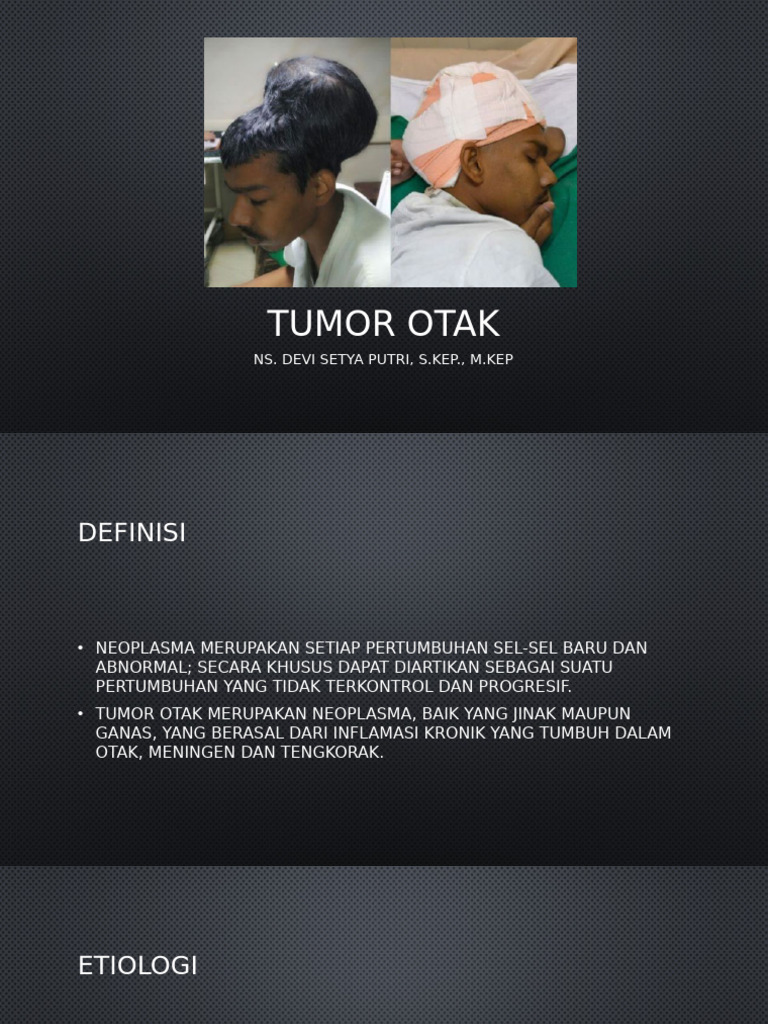 TUMOR OTAK x | PDF