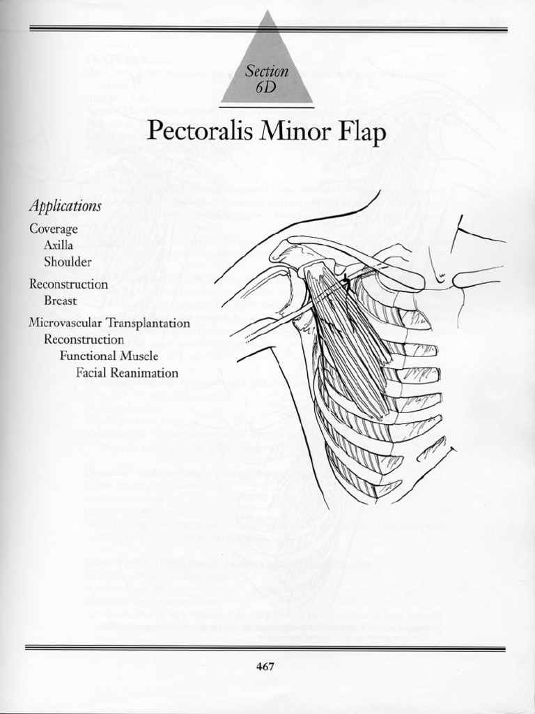 6D - Pectoralis Minor Flap | PDF