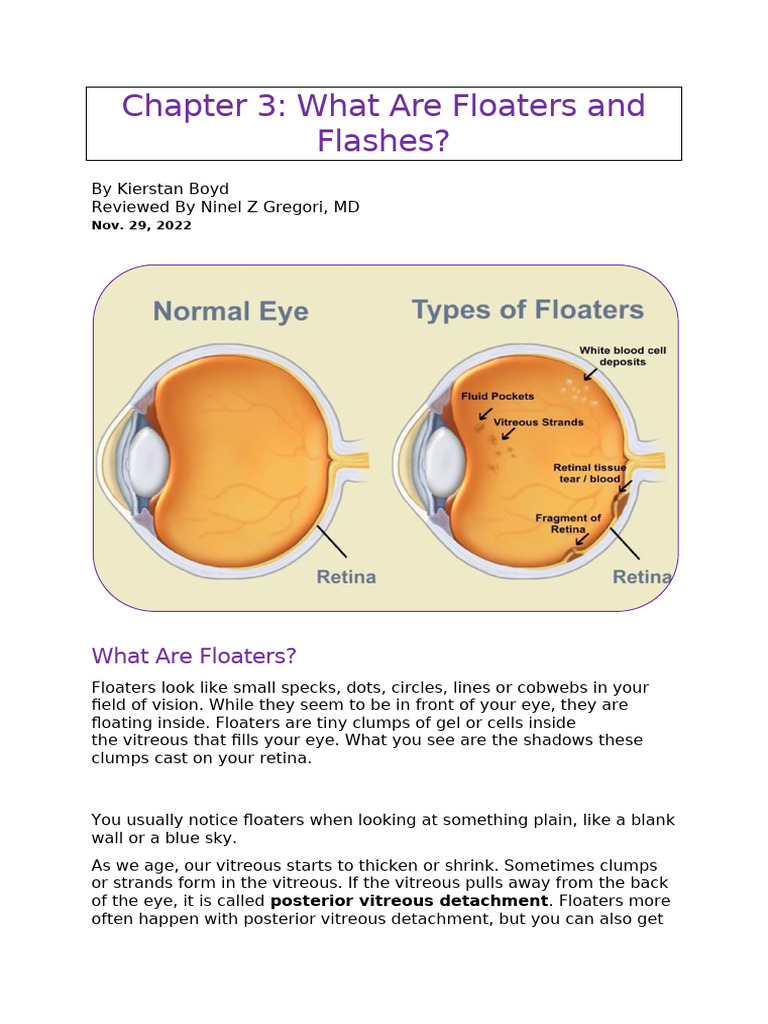 OL2 What Are Floaters and Flashes | PDF