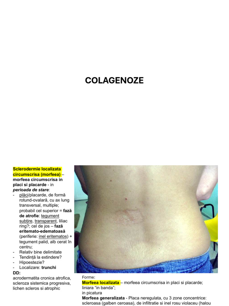 Colagenoze-poze | PDF