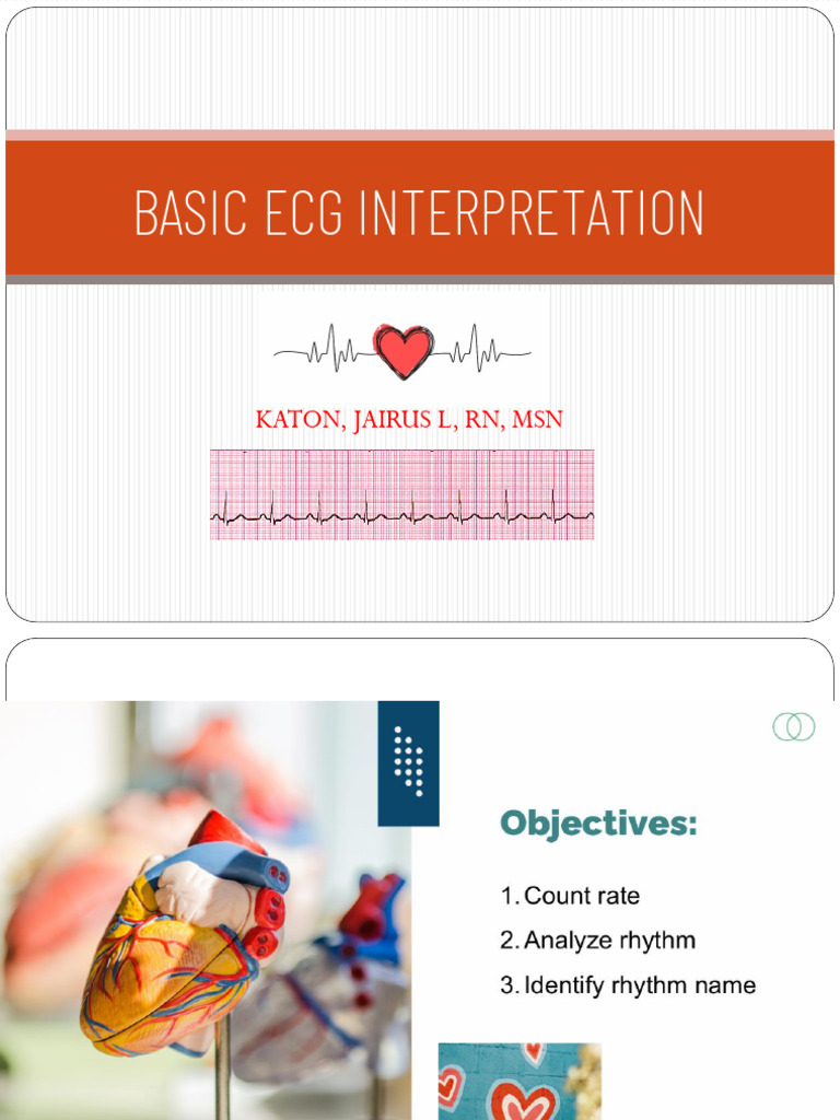 ECG Interpretation 2024 | PDF