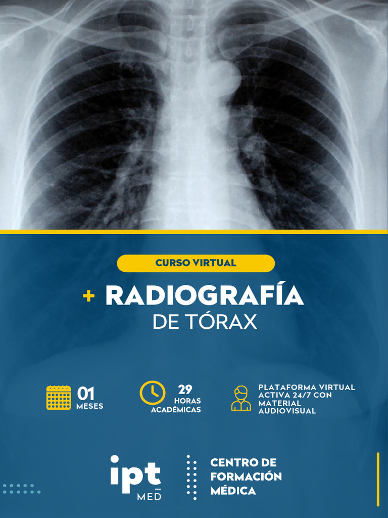Radiografia de Torax | PDF | Radiología | Ciencia y matemáticas