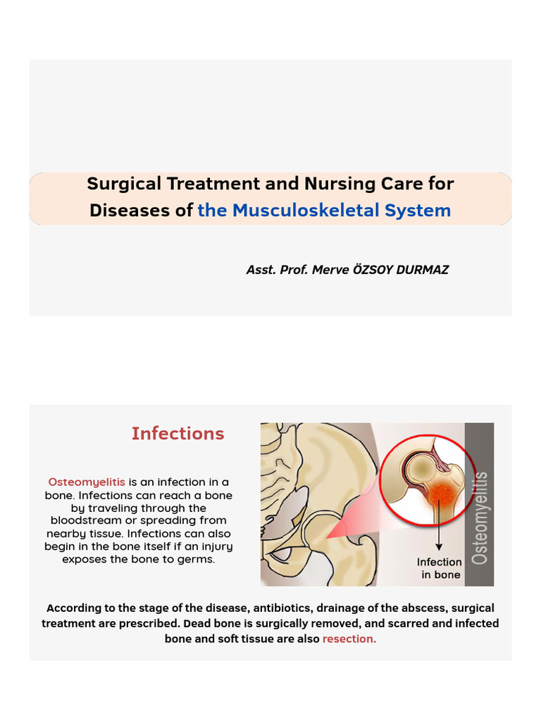 Surgical Treatment and Nursing Care For Diseases of The Musculosceletal ...
