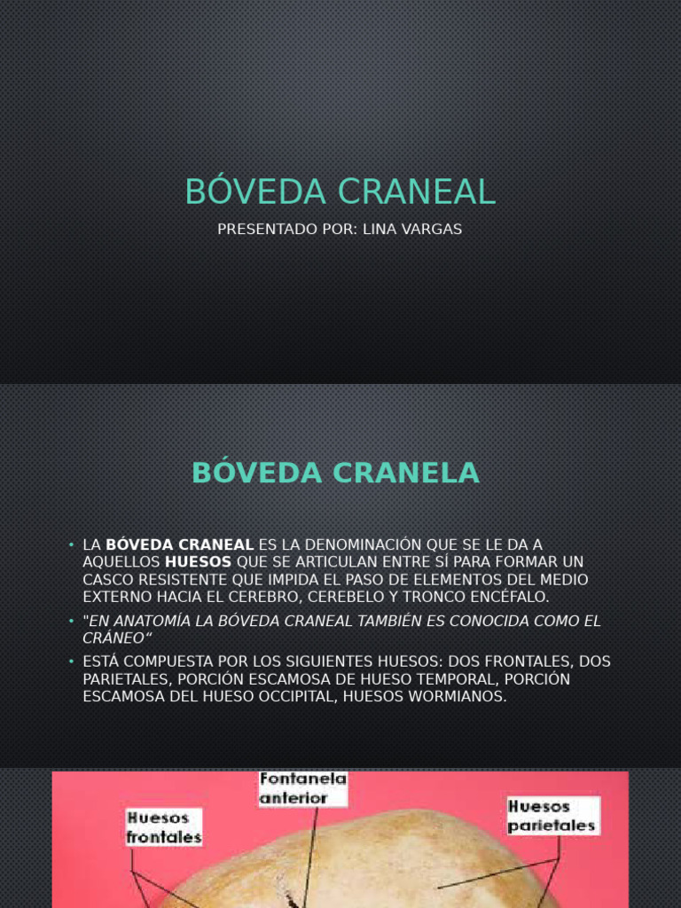 Bóveda Craneal | PDF