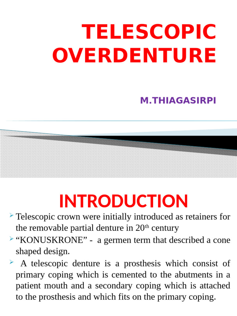 Telescopic Overdenture - Sirpi | PDF