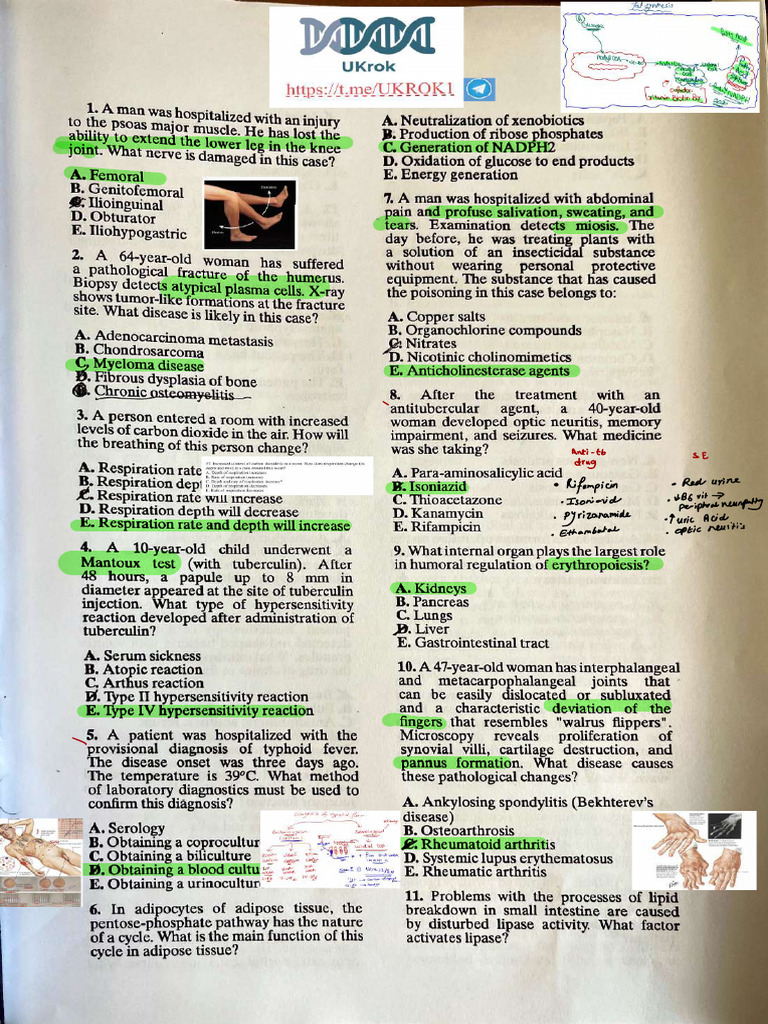 UKROK 2023 June 29 Krok-1 - Compressed | PDF