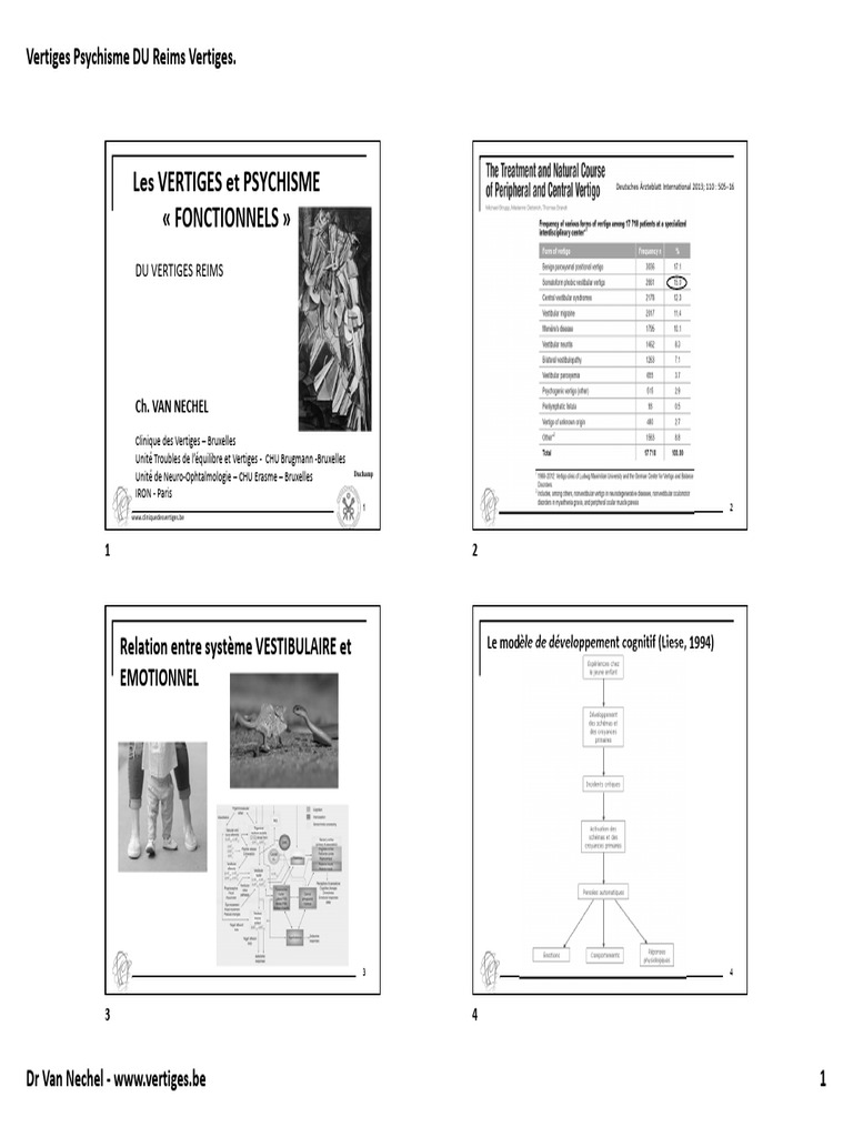 DIU Vertiges Psychogènes V Nechel | PDF