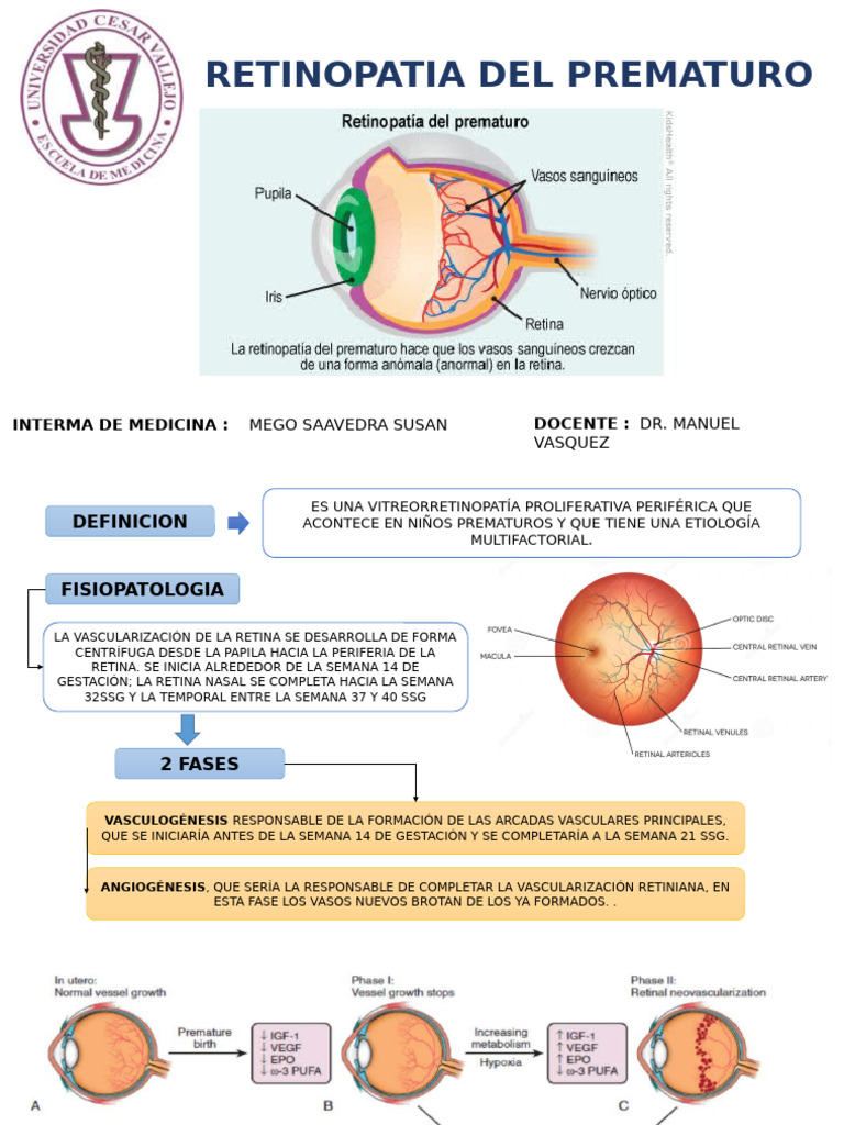 Retinopatia Del Prematuro | PDF